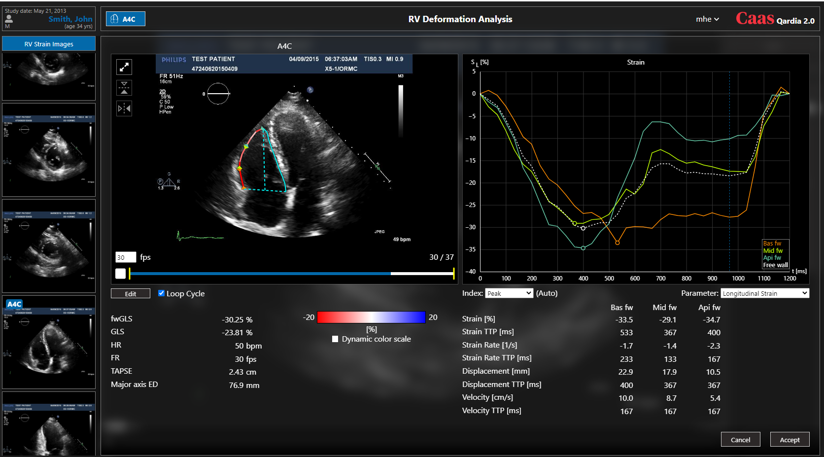 Caas Qardia 2.0 release :: Pie medical imaging